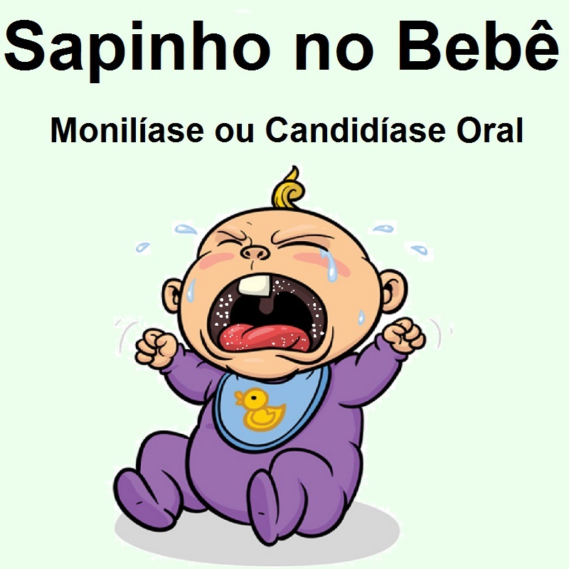 Sapinho no Bebê – PediatriaVirtual.com