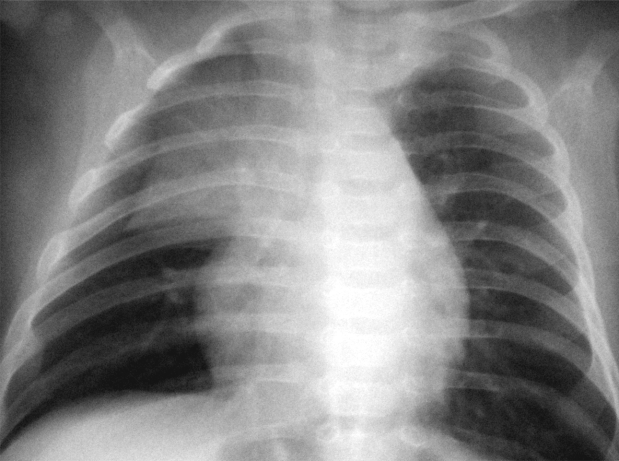 rx timo – PediatriaVirtual.com